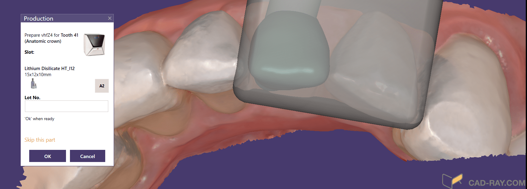 Milling A Lower Central Incisor in an eMax Size 12 Block on the VHF Z4 ...